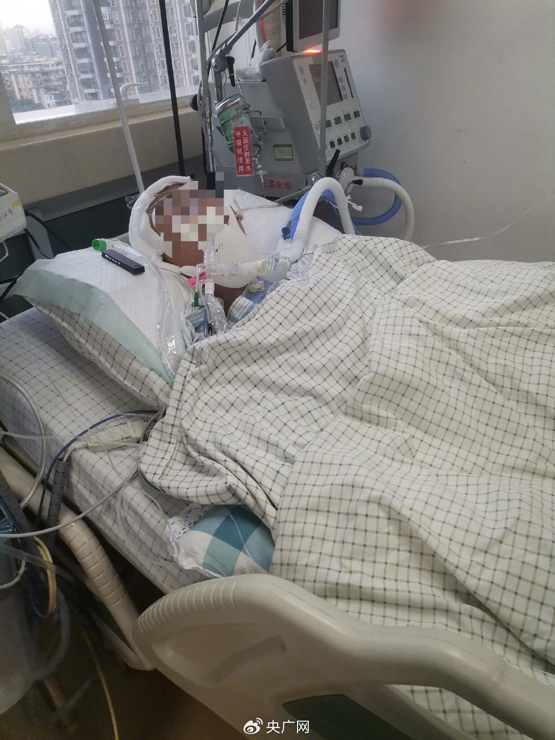 13岁男孩被同学打进ICU，国内顶级医学专家称抢救难度极大